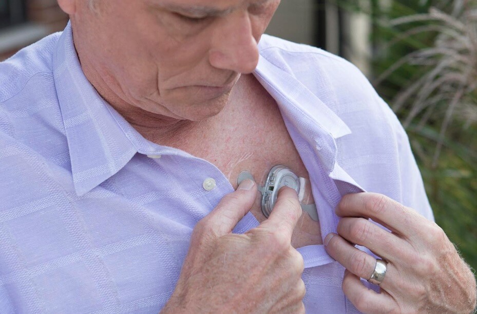 Clinical Trials Enter Homes – about Digital Health